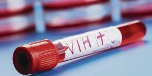 Cameroun : 21 000 nouveaux cas de VIH par an - Journalducameroun.com